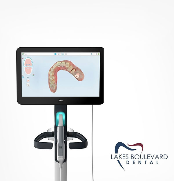 iTero Intra-Oral 3D Digital Scanner | Lakes Boulevard Dental